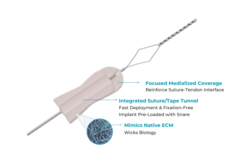 BioCharge® Autobiologic Matrix - Atreon Orthopedics