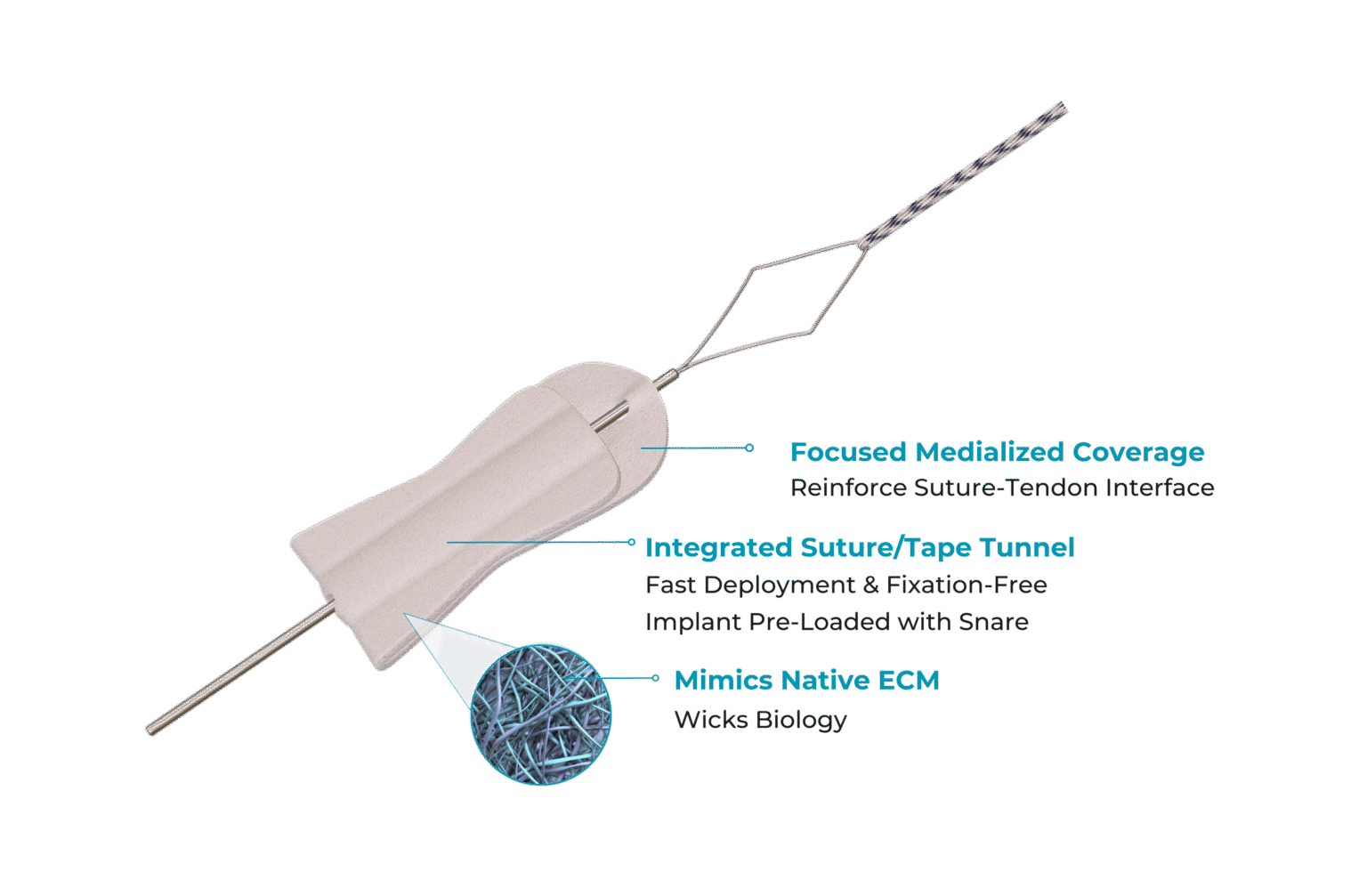 BioCharge® Autobiologic Matrix - Atreon Orthopedics