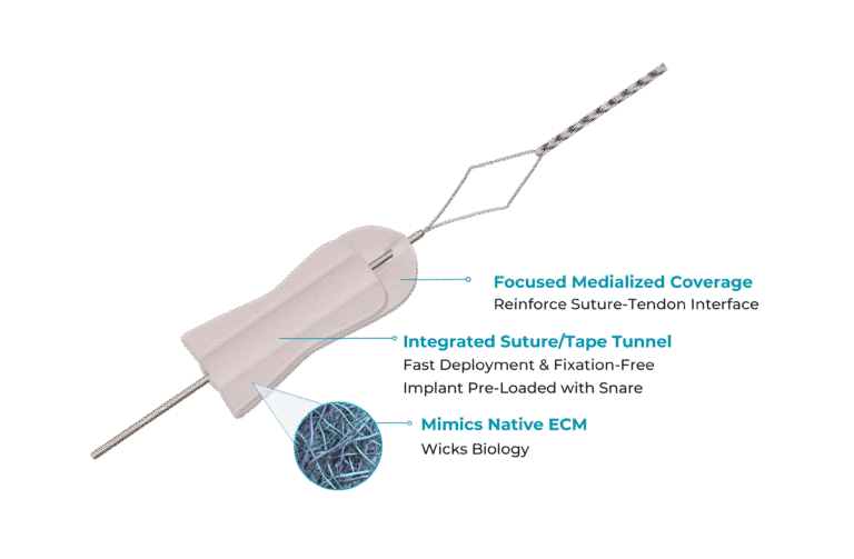 BioCharge® Autobiologic Matrix - Atreon Orthopedics
