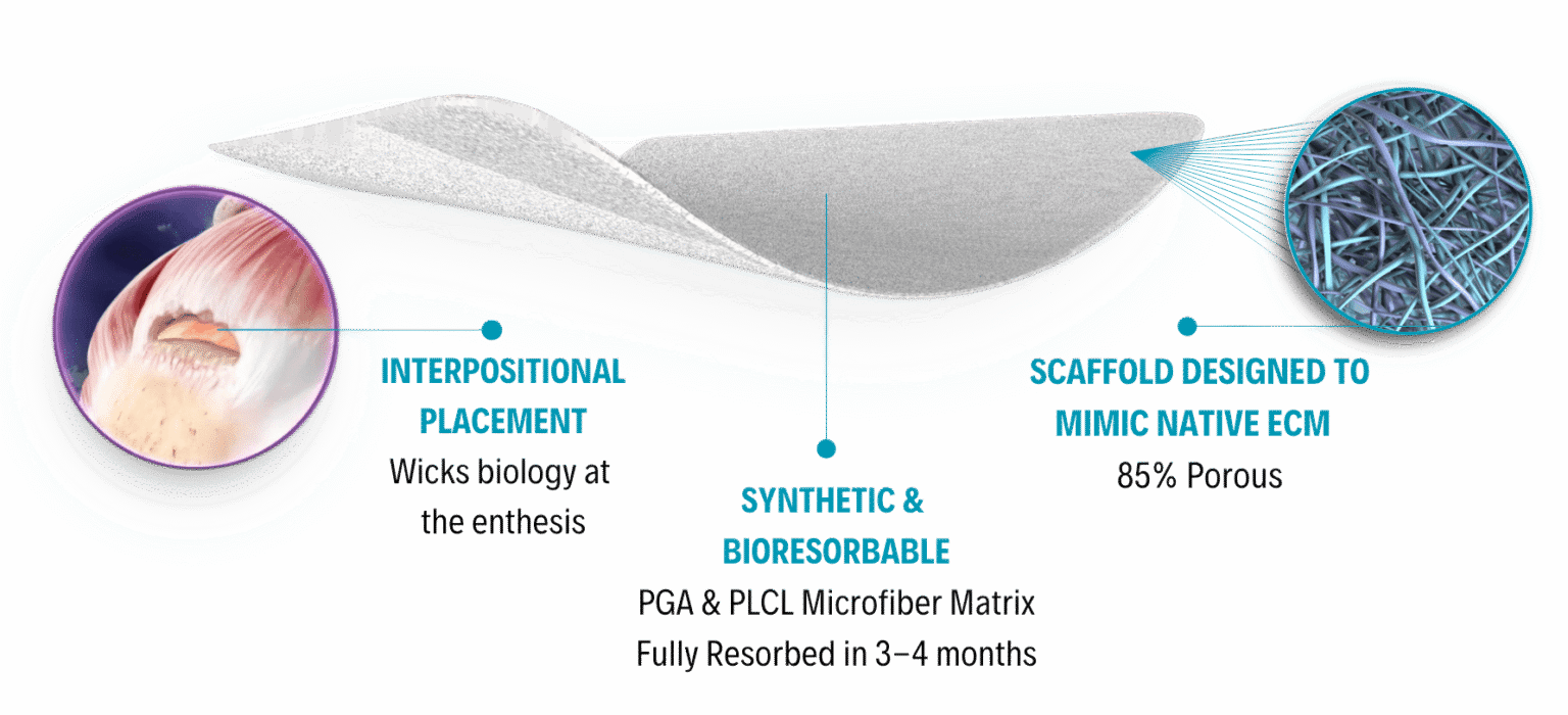 Rotium® Bioresorbable Wick - Atreon Orthopedics