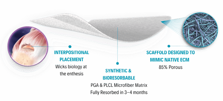Rotium® Bioresorbable Wick - Atreon Orthopedics