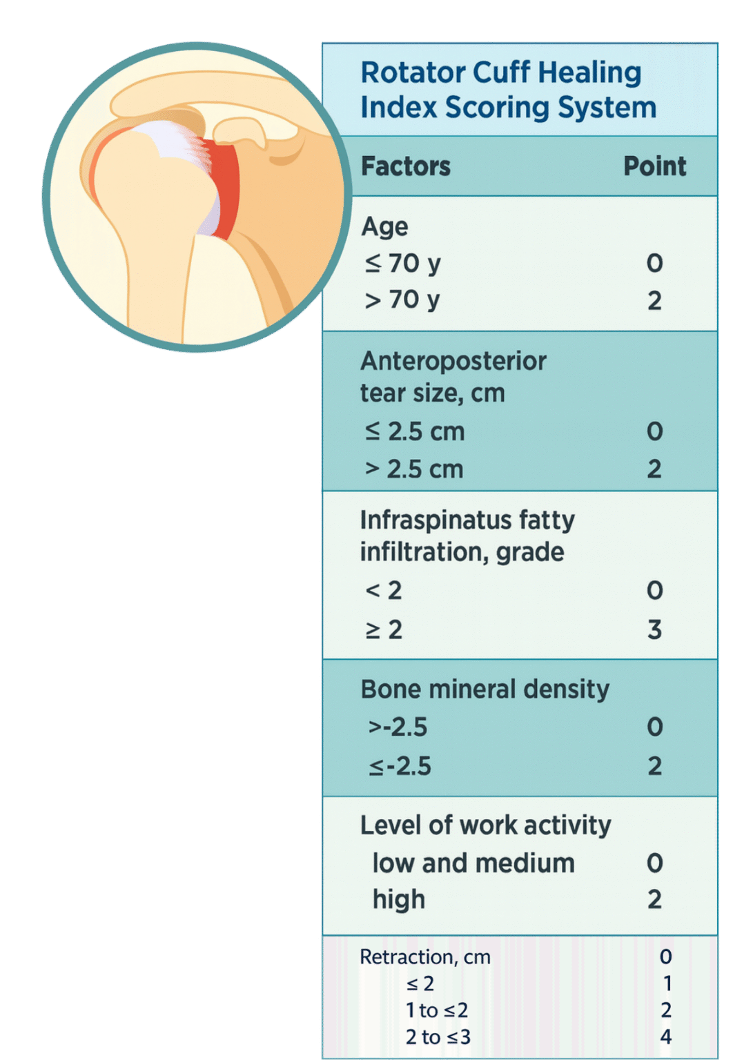 Rotator Cuff Healing Index (RoHI) | Predict Healing Outcomes