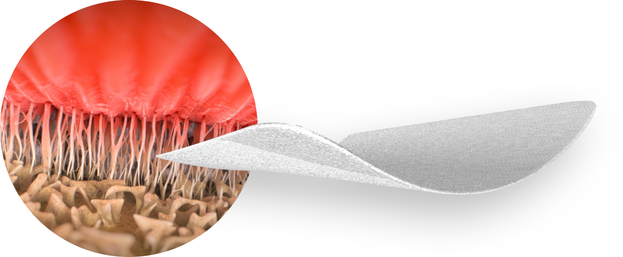 Augmentation of the Quad Tendon Harvest Site with ROTIUM® During ACL ...